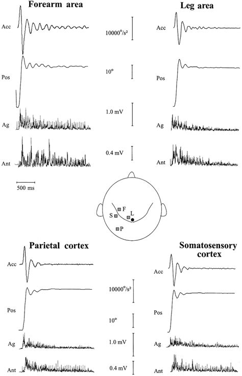 Effects Of Different Stimulus Positions On Rapid Wrist Extension Download Scientific Diagram