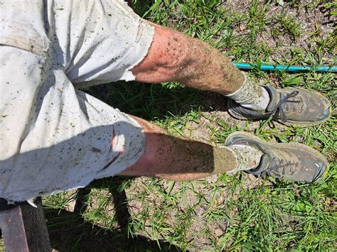 Can String Trimmer Cut Skin Is Your String Trimmer Dangerous