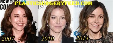 Christa Miller Plastic Surgery Plastic Surgery Feed
