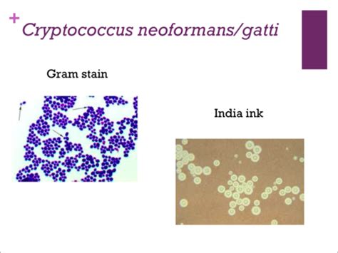 Cryptococcus Neoformans Gram Stain