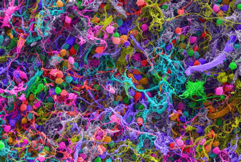 Human Brain Cells Sem Stock Image C030 4663 Science Photo Library