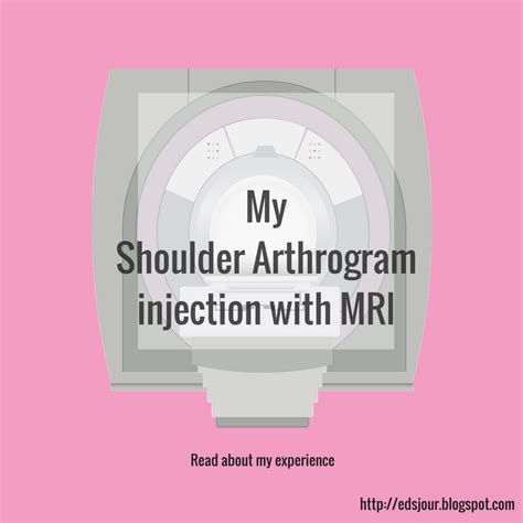 MY EDS JOURNEY My Shoulder Arthrogram Injection With MRI