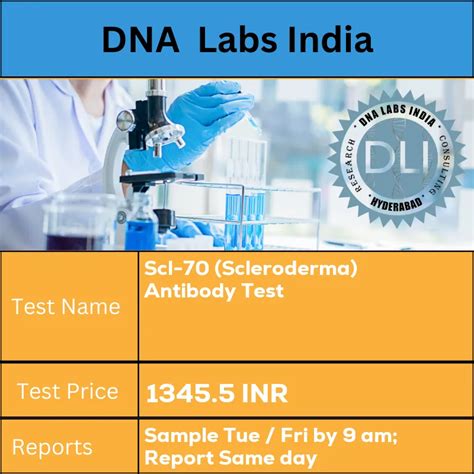 Scl 70 Scleroderma Antibody Test Cost 13455 Inr In India