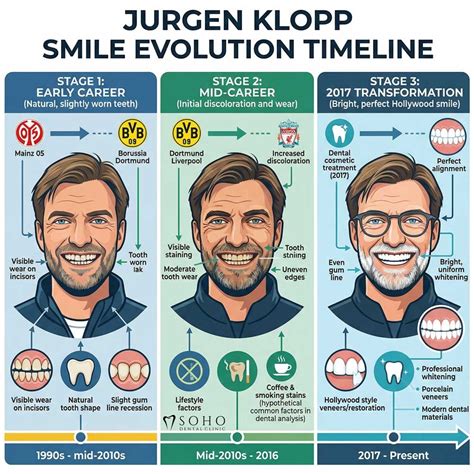 Jurgen Klopp Teeth Before And After Smile Makeover Guide