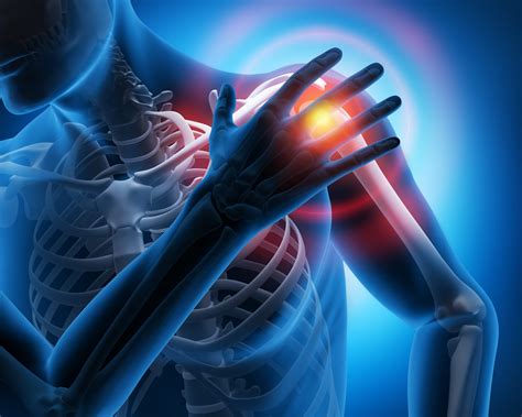 Calcific Tendonitis Shoulder Pain Relief
