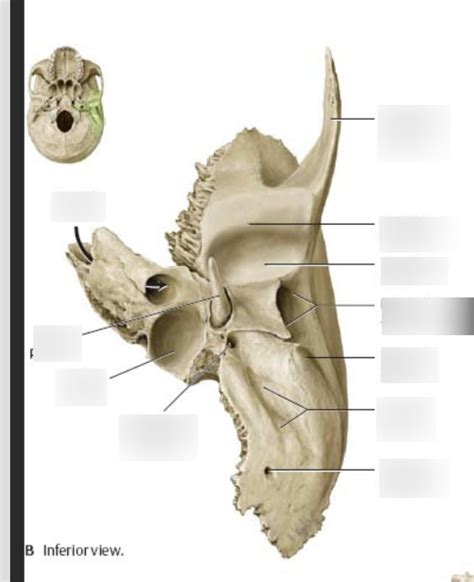 A3 Table 1 Temporal Bone Inferior View Diagram Quizlet