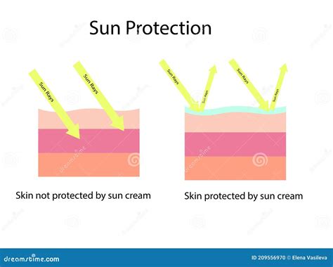 Skin Compare Between Skin With Broad Spectrum Sunscreen Protect Both UVA And UVB And And Normal
