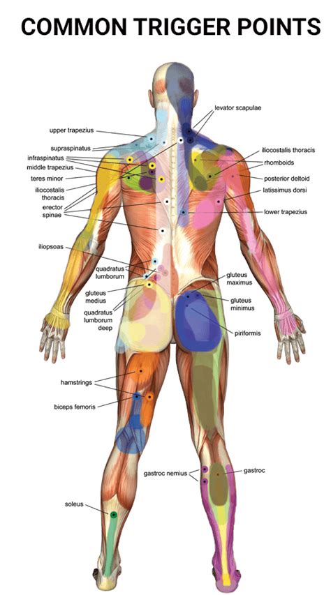 Trigger Point Therapy In New York NY Physical Therapists NYC
