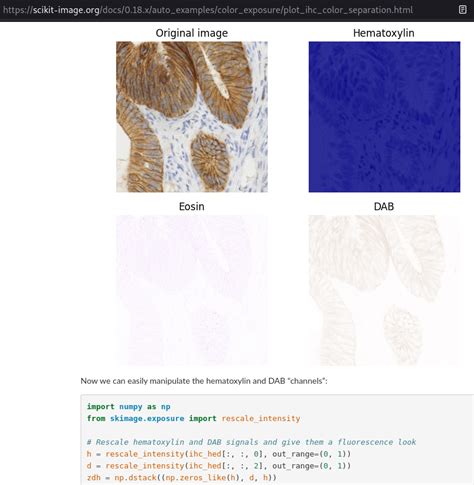 Decomposing Augmenting And Recombining Gives Purple Output · Issue 6648 · Scikit Imagescikit