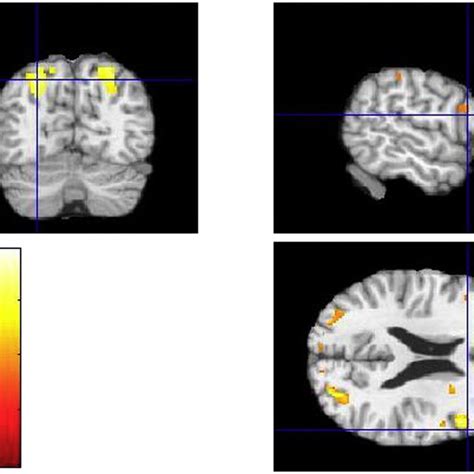 Sample Stimuli From The Fmri Experiment A Relational Reasoning Task Download Scientific