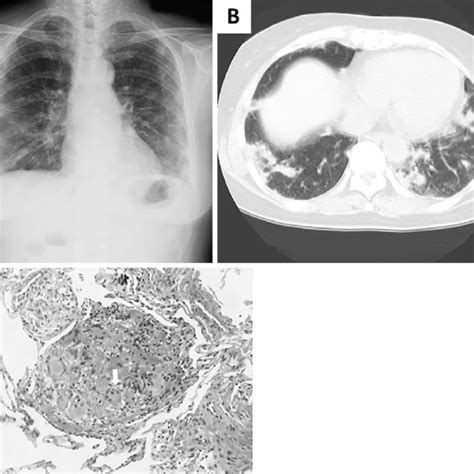 Figure1diagnostic Radiological And Histopathological Findings Related