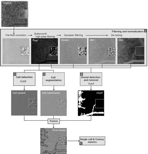 Fully Automated Detection Segmentation And Analysis Of In Vivo Rpe Single Cells Earlysight