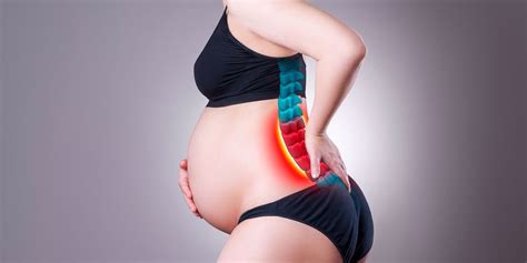 Sciatica During Pregnancy What To Know