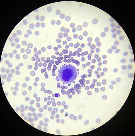 Reactive Mesothelial Cell X100 Oil R Microscopy