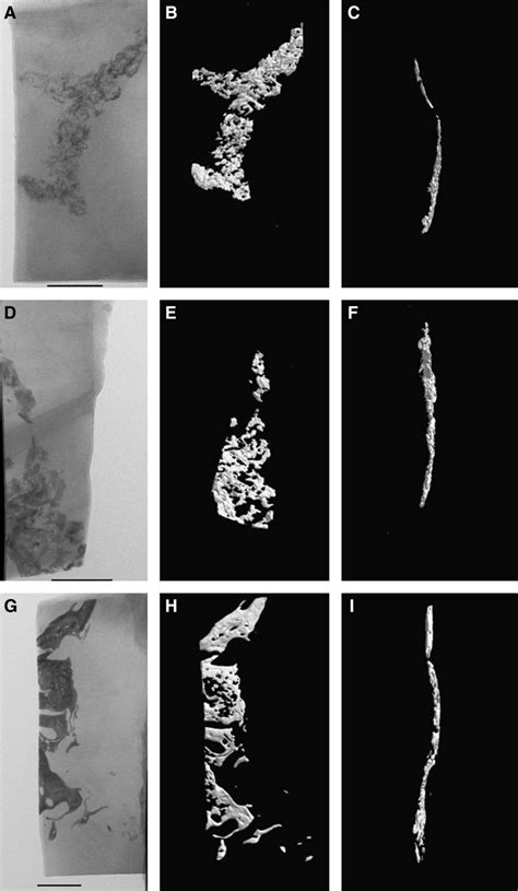 Representative X Ray A D G And Microcomputed Tomography Images