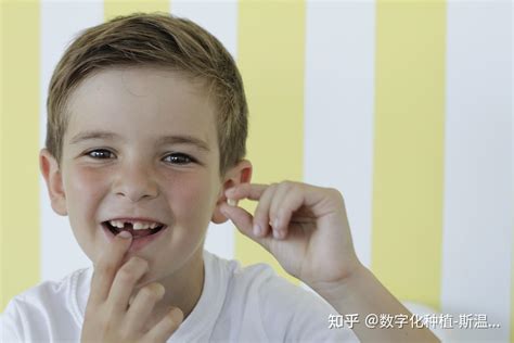 牙齿缺失不修复会造成什么后果？ 知乎