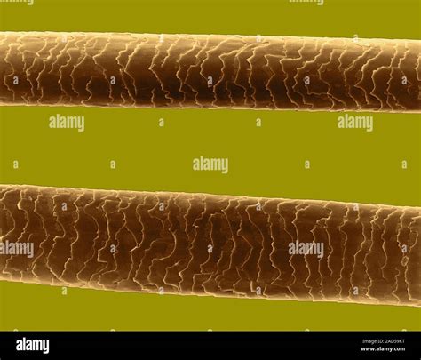 Human Hairs Fine Texture Light Brown Type Caucasian Coloured Scanning Electron Micrograph