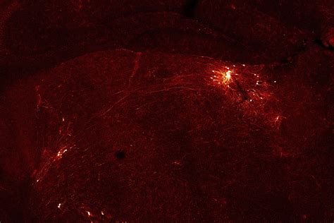 Circuit That Focuses Attention Brings In Wide Array Of Inputs Mit News Massachusetts