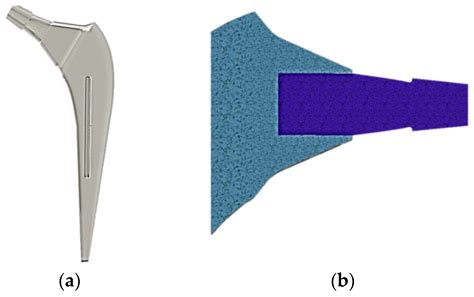 Topology Optimization Of A Femoral Stem In Titanium And Carbon To Reduce Stress Shielding With