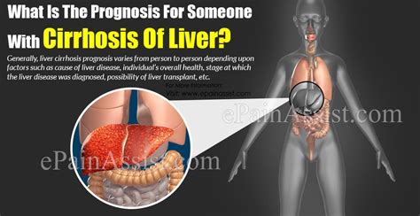 What Is The Prognosis For Someone With Cirrhosis Of Liver