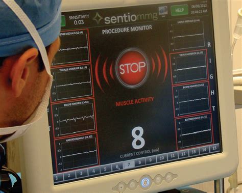 Intraoperative Monitoring Neupsy Key