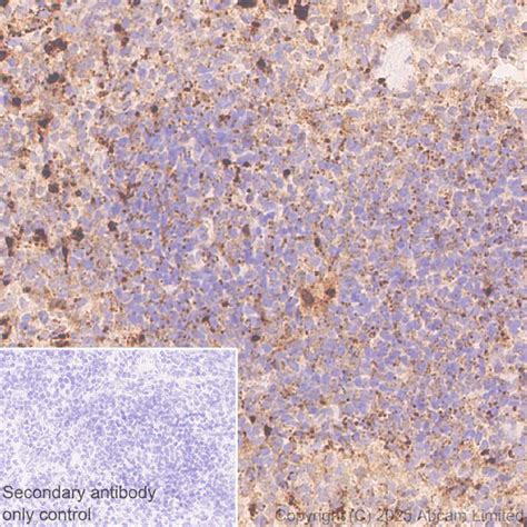 Anti Beta Glucuronidase Gusb Antibody [epr30359 525] Ab324344 Abcam