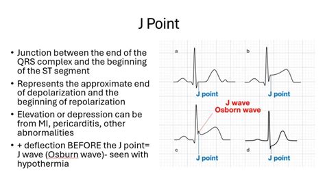 Ekg Made Easy For Medical Professional Etsy
