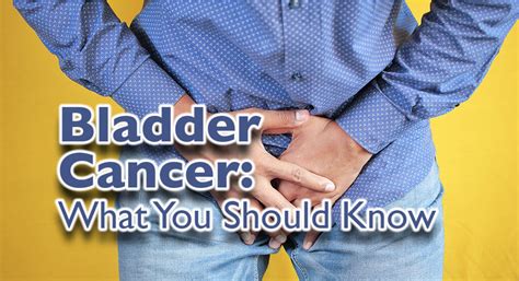 Bladder Cancer What You Should Know About Diagnosis Treatment
