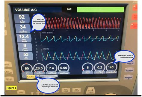Clio2™ Integral To The AveaⓇ Infant Ventilator Download Scientific