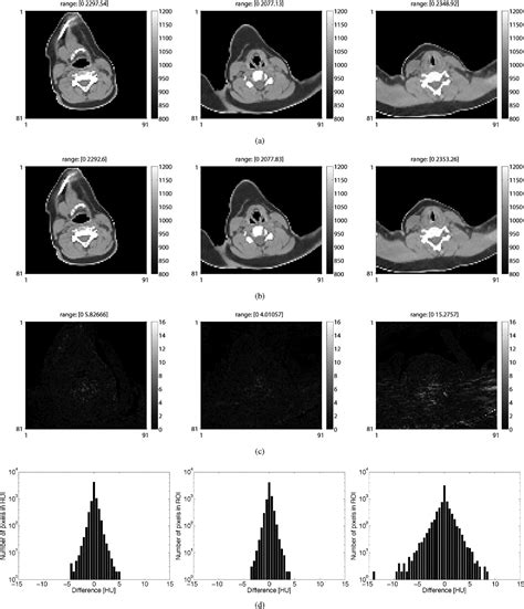 Figure 1 From Forward Projection Architecture For Fast Iterative Image