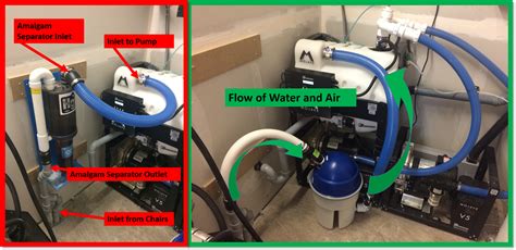 What Is Amalgam Separator At Margaret Burgin Blog