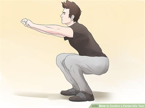 Ways To Confirm A Partial ACL Tear WikiHow