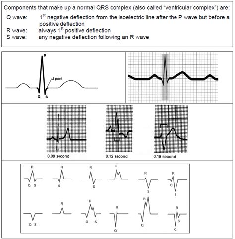 Ecgekg Quizlet At Liam Threlfall Blog