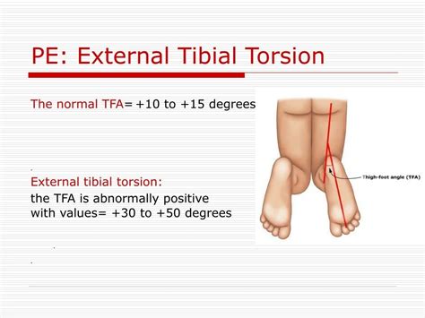 Ppt Birth Deformations Powerpoint Presentation Free Download Id