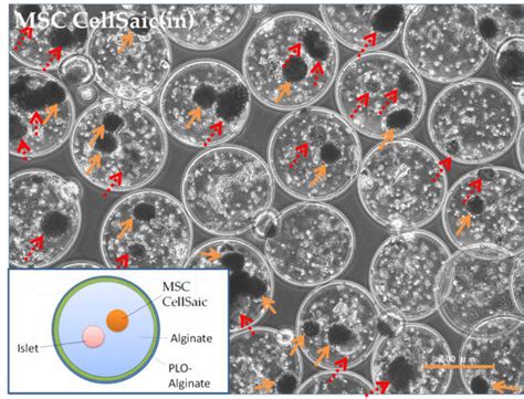 Co Microencapsulation Of Islets And Msc Cellsaics Mosaic Like Aggregates Of Mscs And