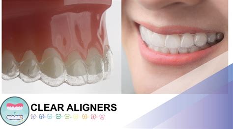 Clear Aligners Sydney Treatment OrthoBoutique