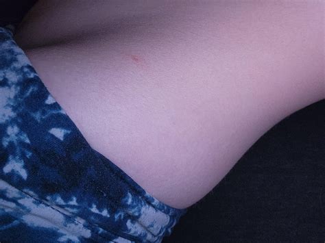 Very Paranoid These Are Bed Bug Bites Pls Help R Bugbites