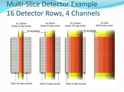 Ppt Multi Slice Ct Powerpoint Presentation Free Download Id5573730