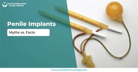 Penile Implants Myths Vs Facts Expert Insights By Dr Arif Akhtar