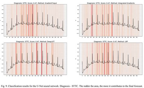 Dsp Explainable Artificial Intelligence Techniques In Medical Signal Processing By Minesh A