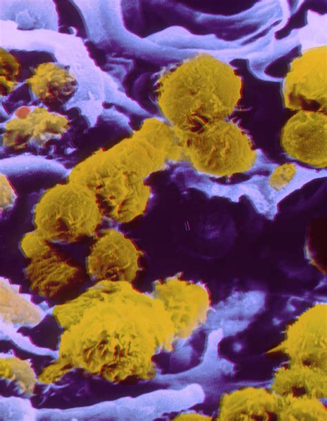 Fcol Sem Of Subcapsular Sinus In Lymph Node Photograph By Cnriscience Photo Library Pixels Fcol Sem Of Subcapsular Sinus In Lymph Node Photograph By Cnriscience Photo Library Pixels