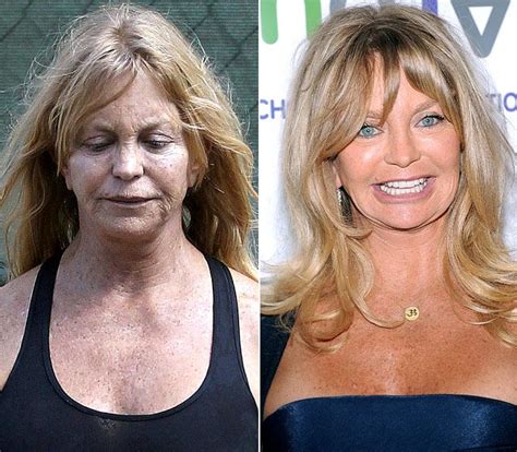 Celebrities Without Makeup Before And After Surgery