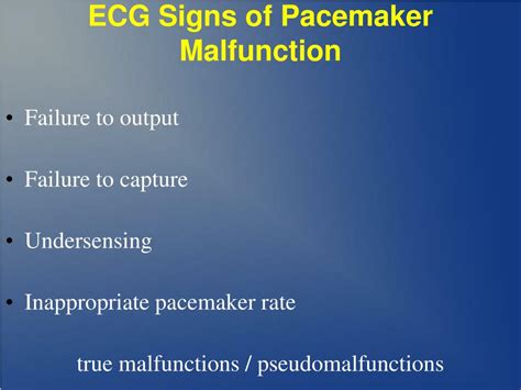 Ppt Pacemaker Malfunction Powerpoint Presentation Free Download Id 5755499