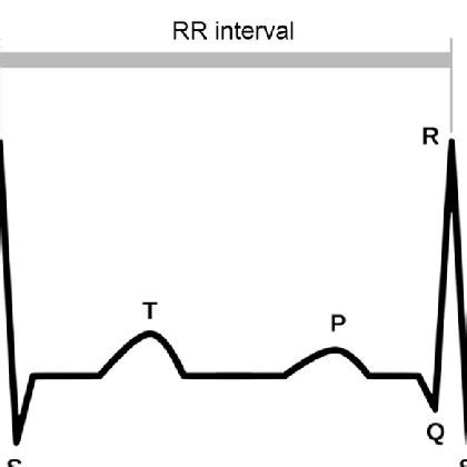 The Schematic Representation Of The RR Interval Download Scientific Diagram