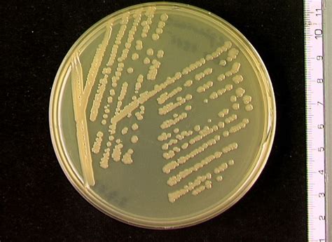 Bacillus Sphaericus Alchetron The Free Social Encyclopedia