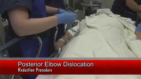 Elbow Dislocation Reduction