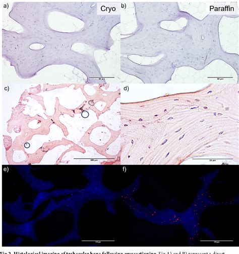 Figure 1 From Quantitative Analysis Of Trabecular Bone Tissue Cryosections Via A Fully Automated