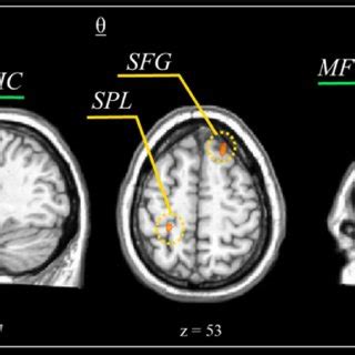 Sex Differences In Flanker Related Interference Activity Maps Are Download Scientific Diagram