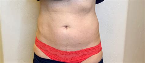 Evolve Transform The Hormone Zone Med Spa