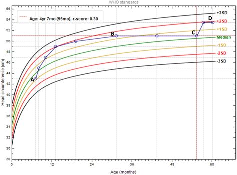 Head Circumference Mnemonic At Joshua Mabon Blog